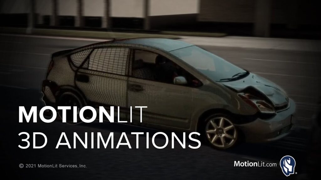 3D Reconstruction Shows Mechanism of Injury In Rear-End Intersection ...